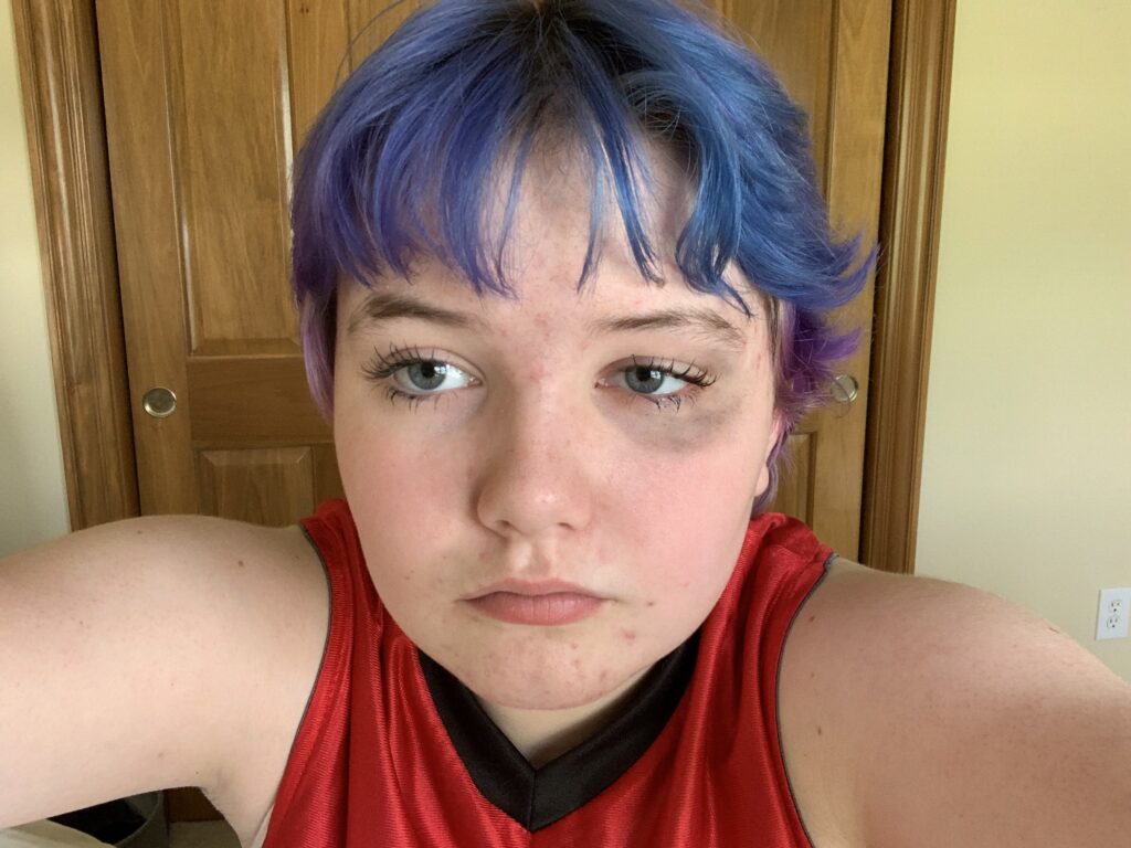 I ve Had Three Black Eyes In My Life Midlife Mama